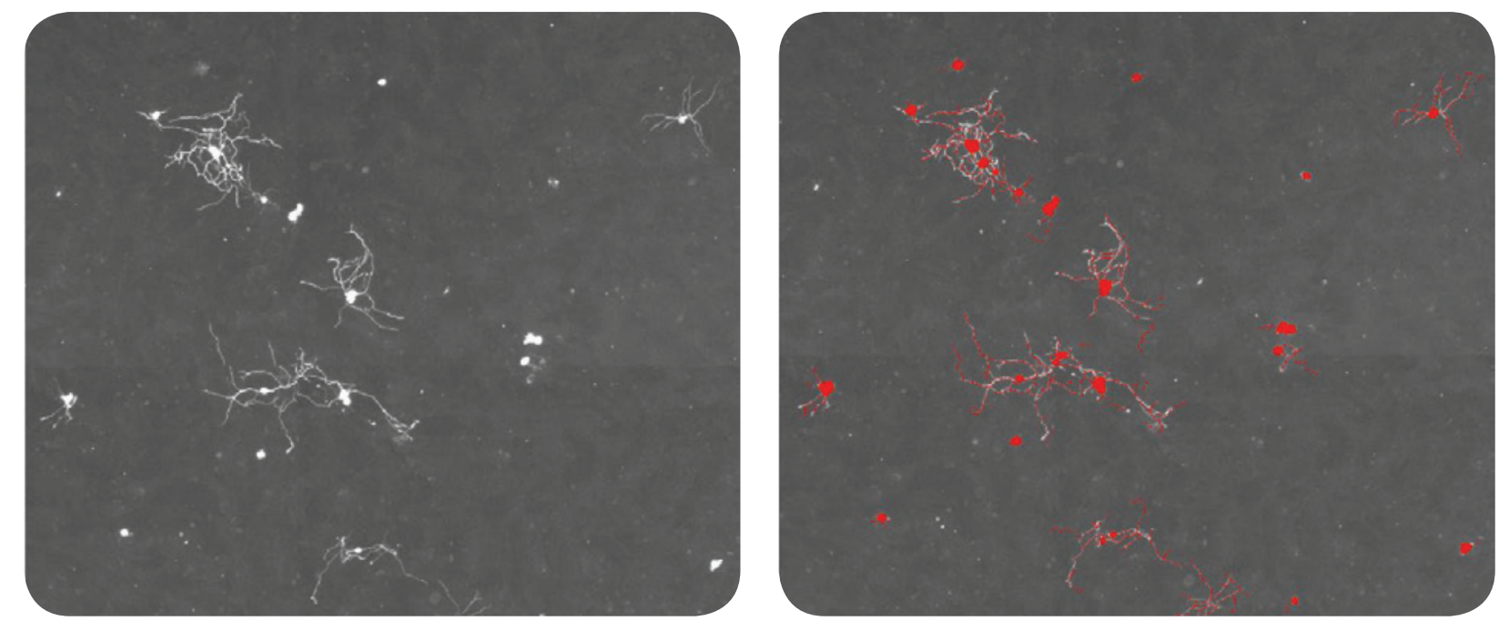 应用SpectraMax MiniMax细胞成像系统和MetaMorph软件测量神经突触 - 知乎
