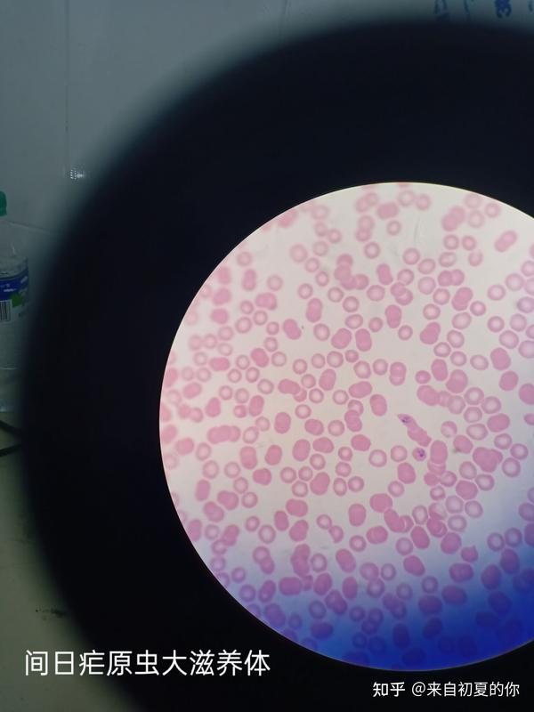 寄生虫标本考试 - 知乎