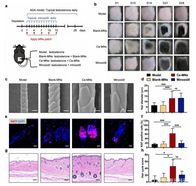 别人脱单你脱发，想知道这是什么原因吗？ - 知乎