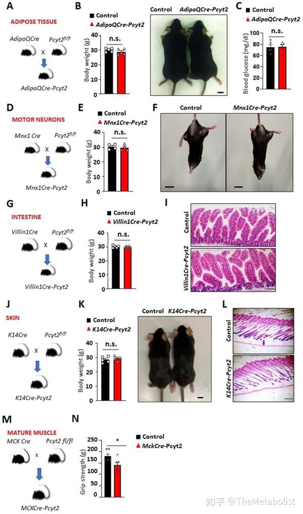 代谢学人——Nature Metabolism：PCYT2调控的脂质合成对与肌肉健康和衰老至关重要 - 知乎