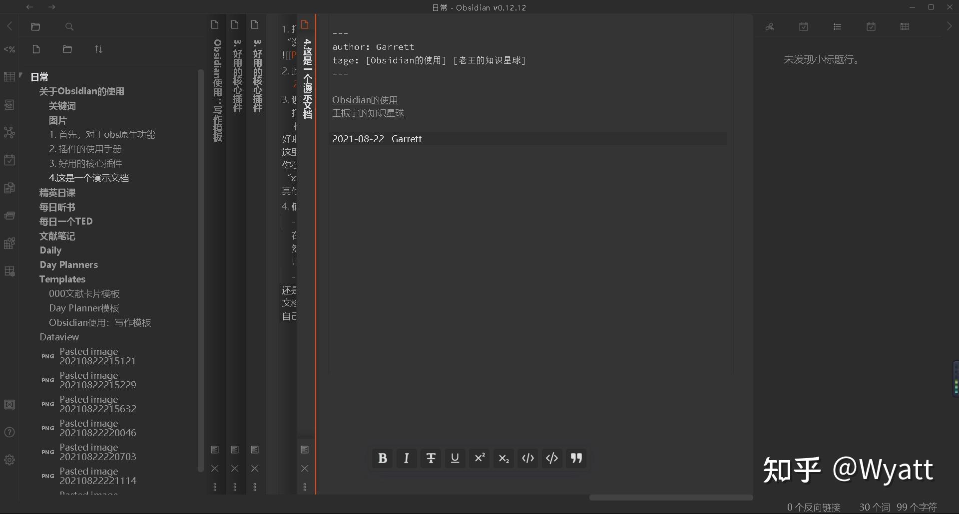 模板——践行模块化思维【玩转Obsidian的保姆级教程】 - 知乎