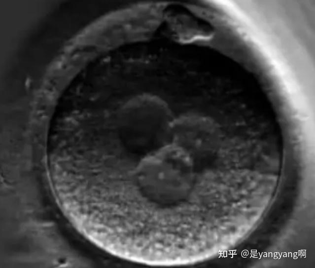 胚胎受精（有效区分0PN，1PN，2PN，3PN/4PN） - 知乎