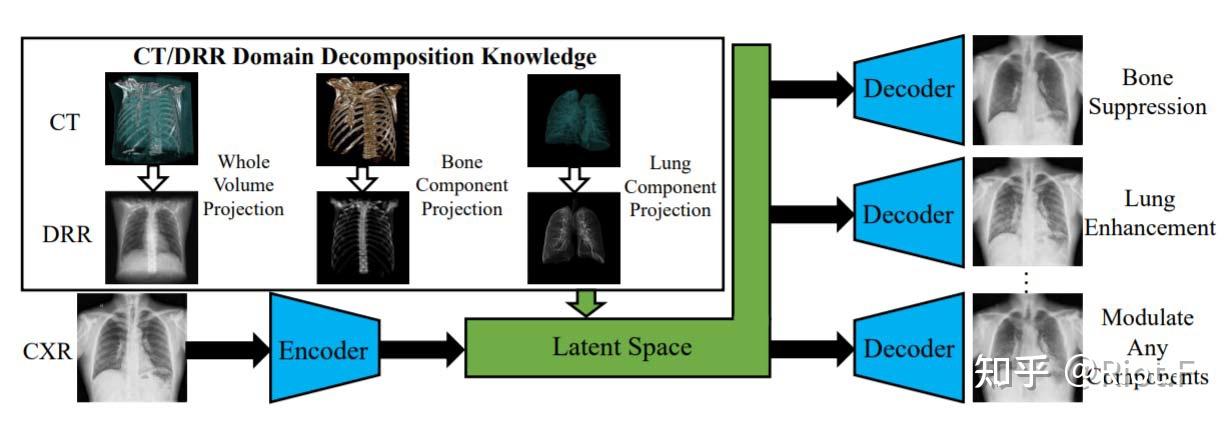 A Review of Deep Learning in Medical Imaging【综述笔记】 - 知乎