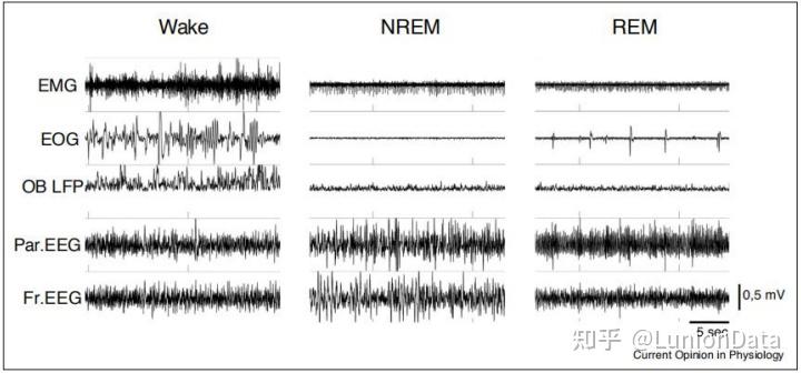 【脑科学】动物睡眠病状中的REM Sleep - 知乎