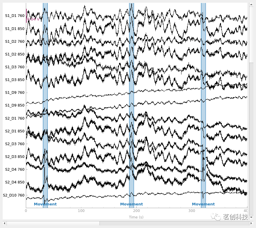 含教程 | 时间导数分布修复(TDDR)：fNIRS运动校正方法 - 知乎