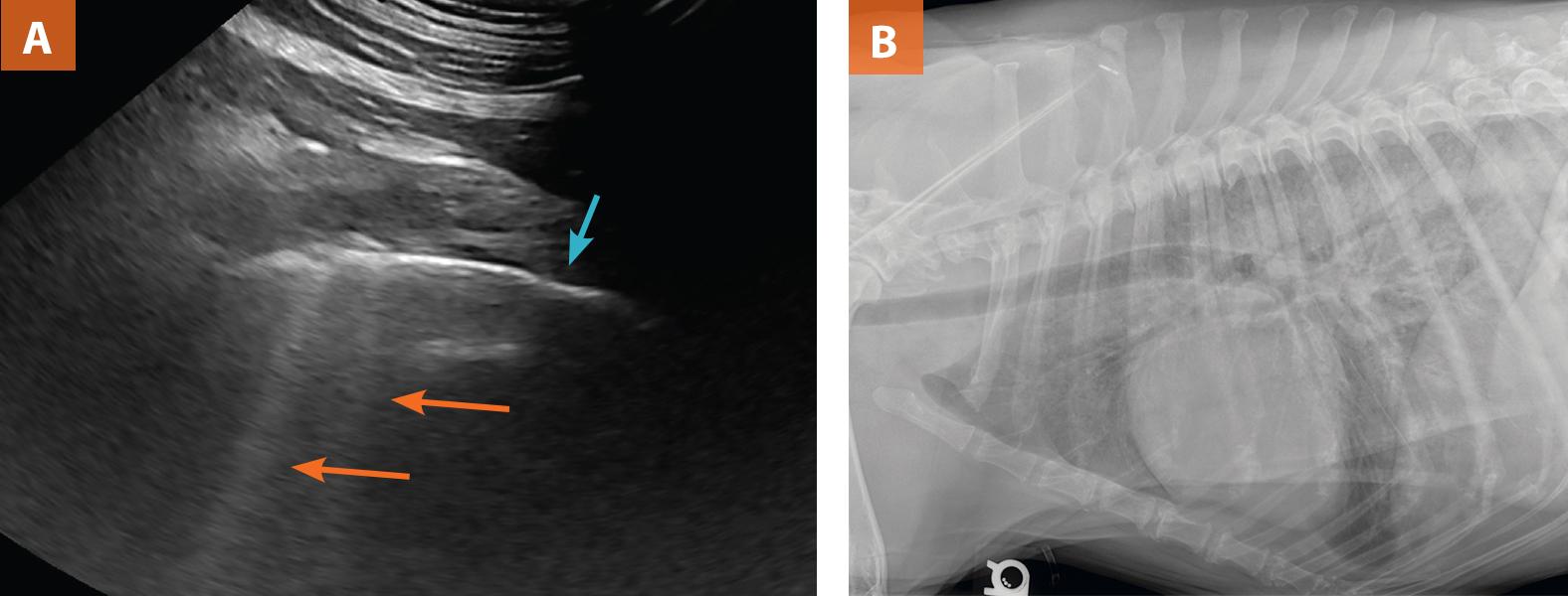 超声评估：AFAST和TFAST概述 - 知乎