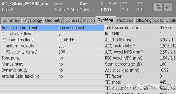4D-Flow扫描数据采集：序列及参数 - 知乎