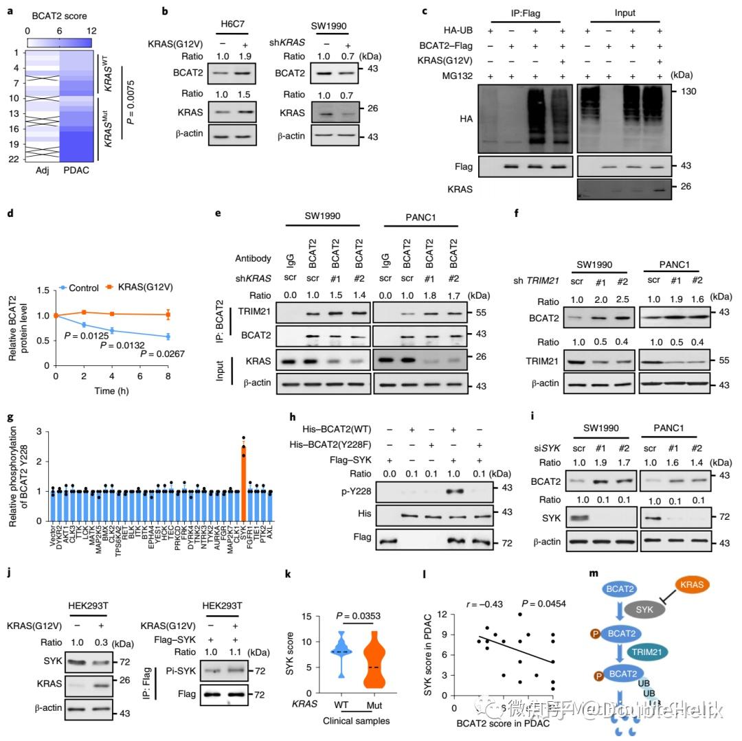 Nature子刊|BCAT2介导的BCAA分解代谢是胰腺导管腺癌发生发展的关键 - 知乎