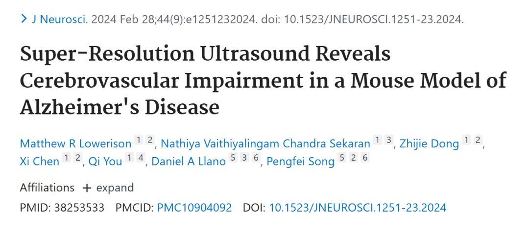 J Neurosci:超分辨率超声 “透视” 阿尔茨海默小鼠脑内血管 - 知乎