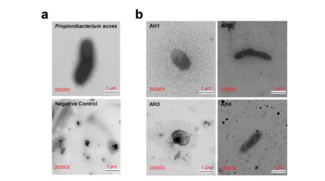 干性AMD全球尚无有效治疗手段，国内创新药带来研发希望！ - 知乎