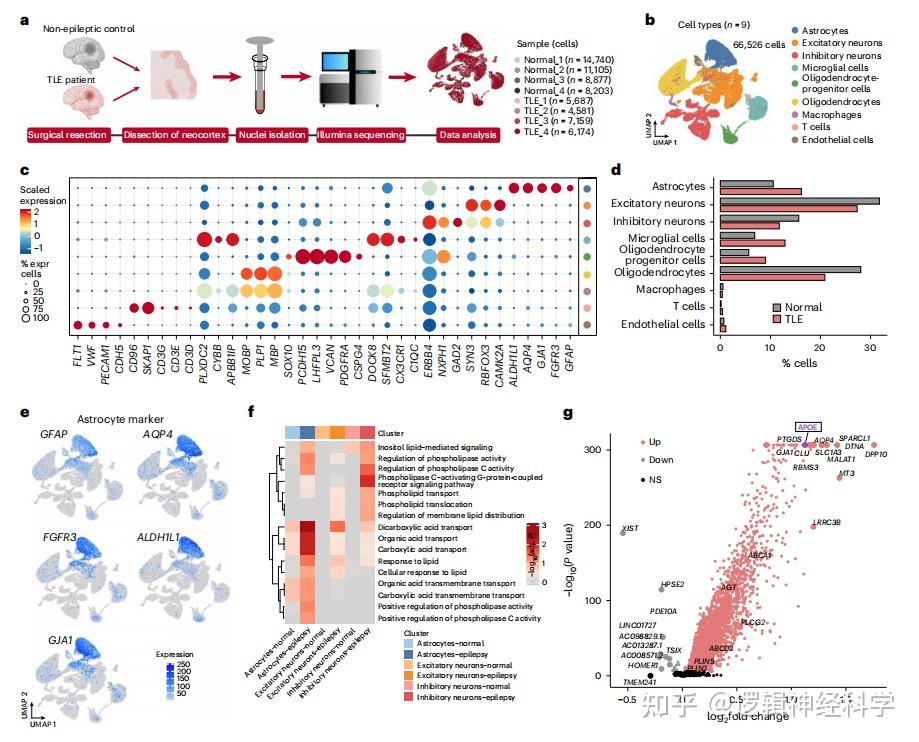 专家点评 Nat Neurosci︱突破！南京大学闫超团队揭示脂质堆积的反应性星形胶质细胞促进癫痫疾病进展 - 知乎