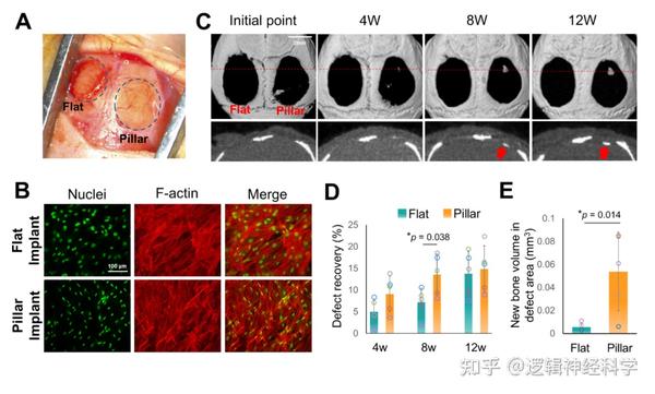 Nat Biomed Eng︱西北大学Ameer/Backman团队揭示染色质工程在骨组织再生中的应用 - 知乎