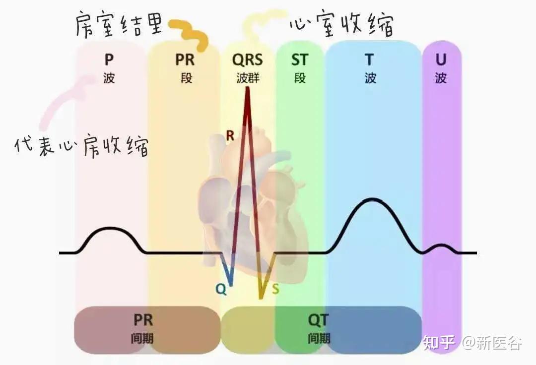 谷谷给你讲解WPW综合征 - 知乎