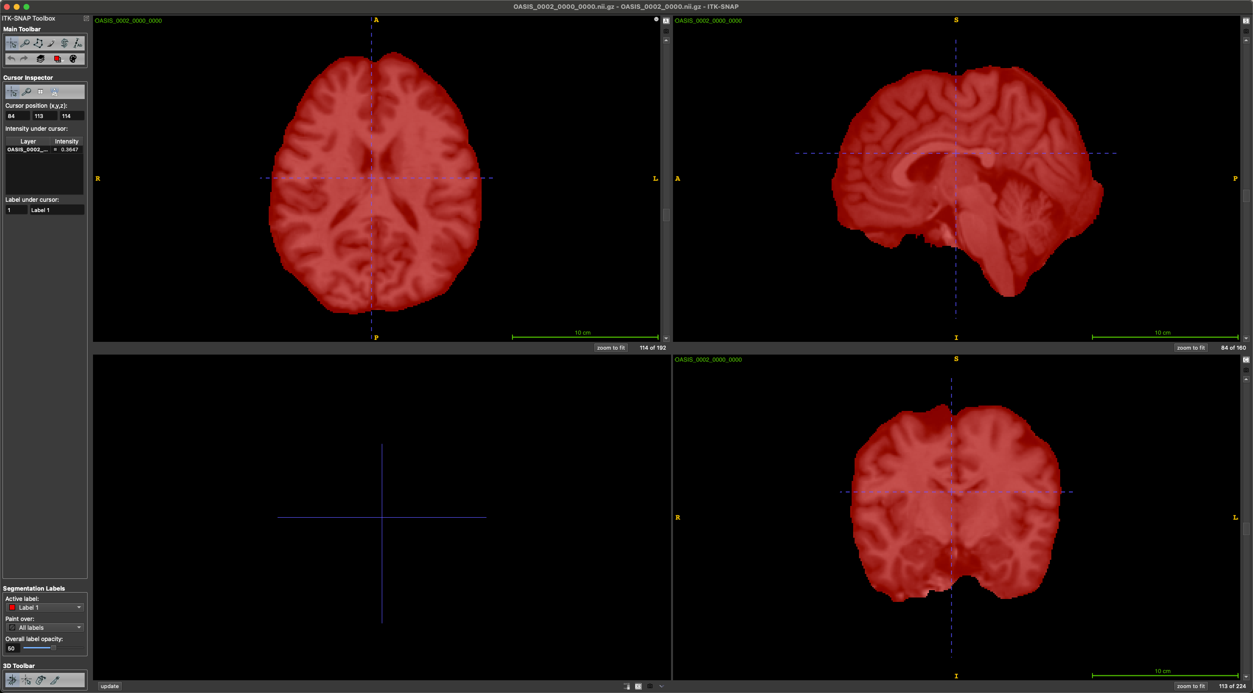 L2R-OASIS 大脑分割与配准 MR 数据集介绍 - 知乎