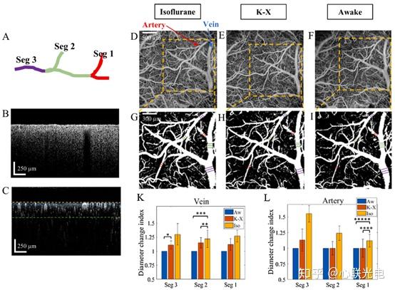 J NEUROSCI METH：定量OCTA揭示清醒与麻醉小鼠脑皮层的血管和血流差异 - 知乎