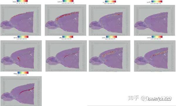 Seurat包学习笔记（三）：Analysis of spatial datasets - 知乎