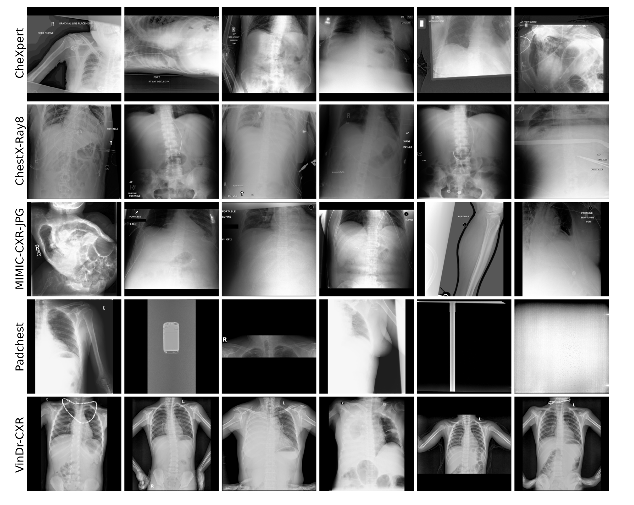 CheXmask Database 数据集介绍 - 知乎