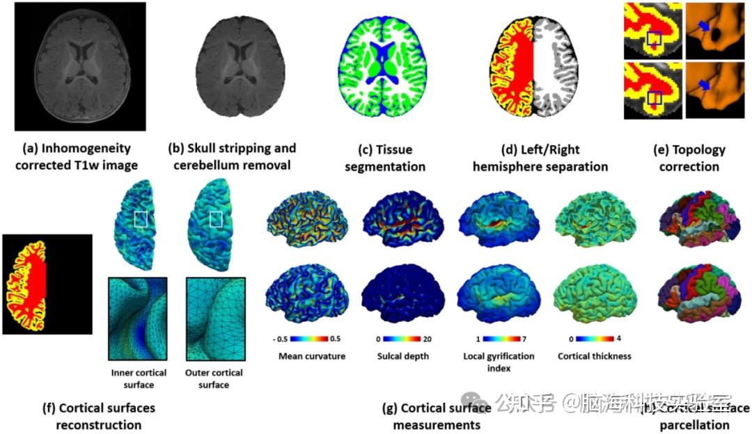 iBEAT V2.0：一个多站点的、基于深度学习的婴儿大脑皮层表面重建Pipeline - 知乎