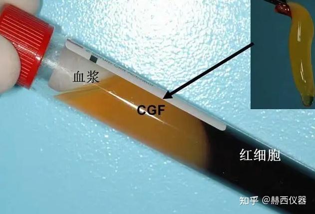 口腔种植专用CGF高浓缩生长因子变速离心机原理介绍 - 知乎