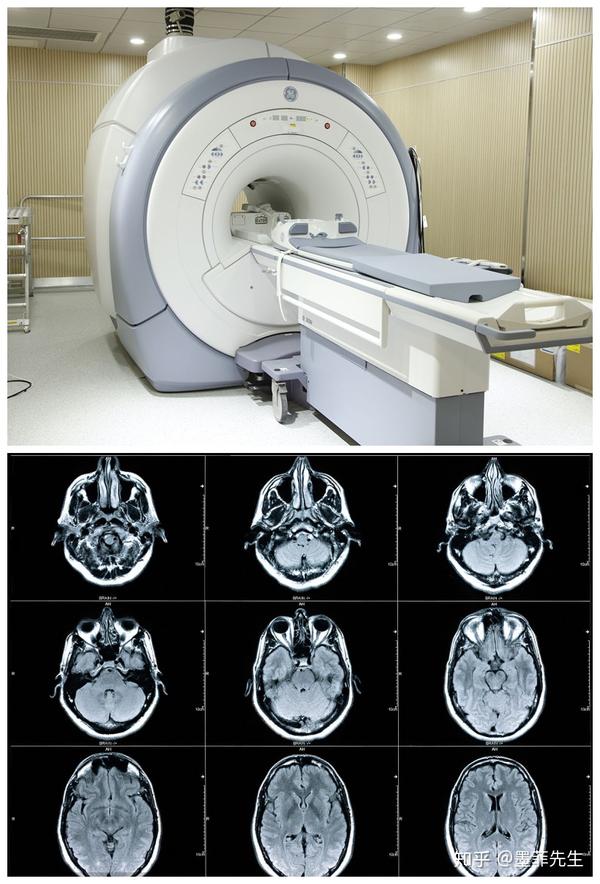 B超、DR、CT、MRI是什么东西？ - 知乎
