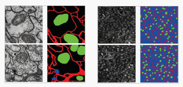CVPR2020 | 细胞图像分割的反馈U-net方法 - 知乎