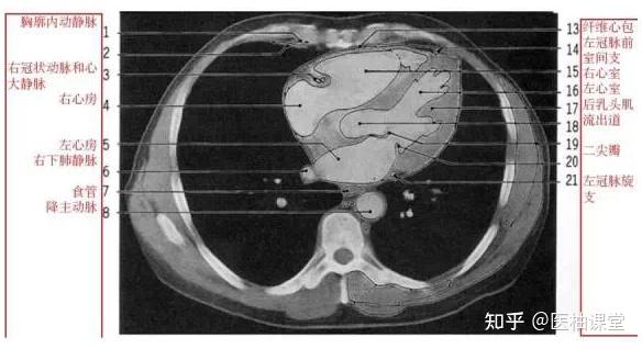 教你读懂胸部CT - 知乎