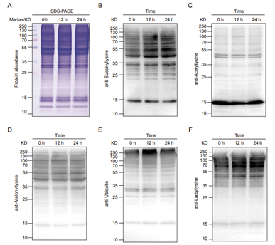 WB的无敌战神之路——WB的内参选择 - 知乎