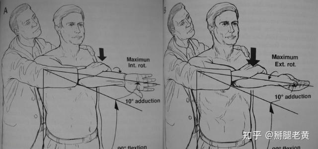 肩膀SLAP损伤是什么病？关于SLAP损伤这六点你需要注意 - 知乎