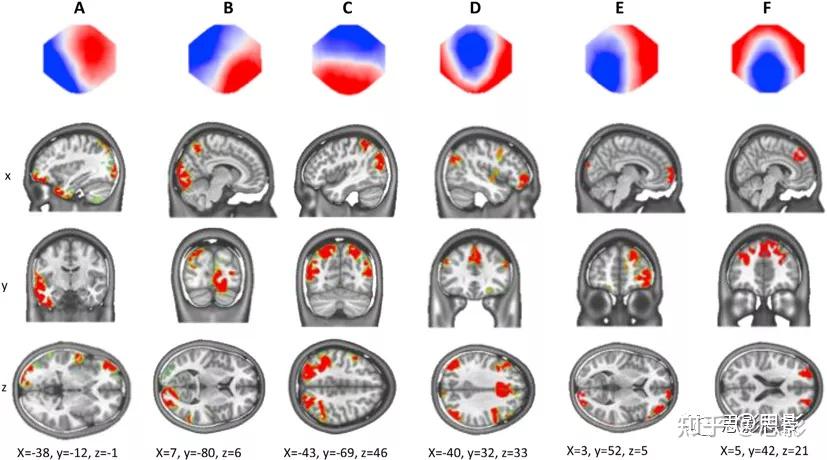 利用脑电和功能磁共振成像(fMRI)捕捉自我生成、任务启动的思维的时空动态 - 知乎