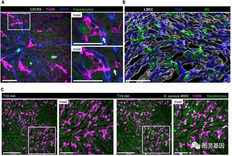 Science ｜ 肝脏的自救：Kuffer合胞体在纤维化肝脏中补充巨噬细胞功能 - 知乎