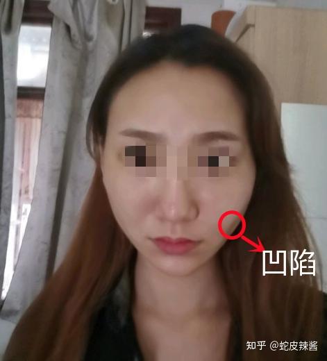 超声炮原理是什么 知乎