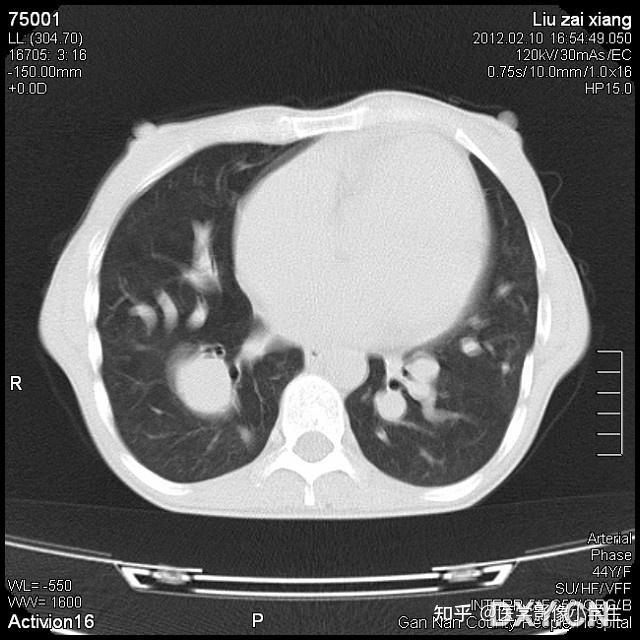 如何分辨DR、CT、MR，以及胶片前后左右定位？ - 知乎