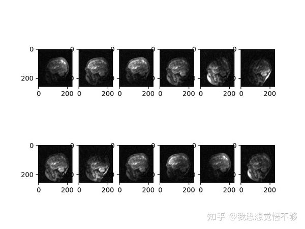 MRI重建中的小实验（python） - 知乎