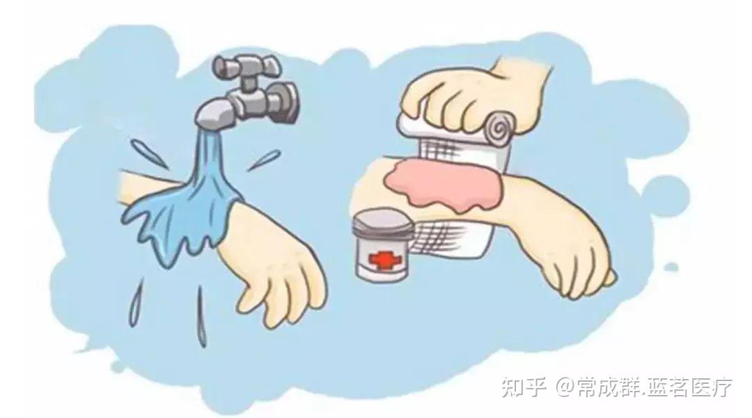 烧伤烫伤后应该如何处理？ - 知乎