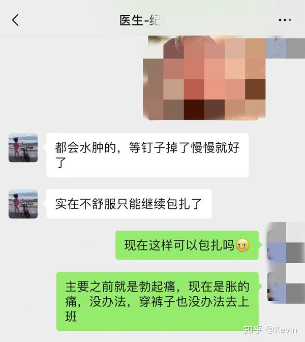 成年人到底要不要割包?28岁割包皮的亲身经历(术后20天总结) 知乎