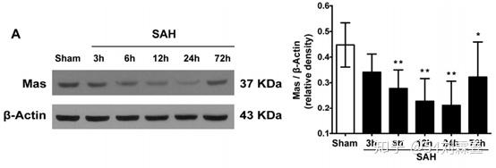Western blot实验---从入门了解到SCI写作 - 知乎
