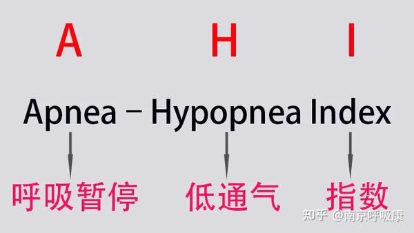 我需要调参数吗？ - 知乎