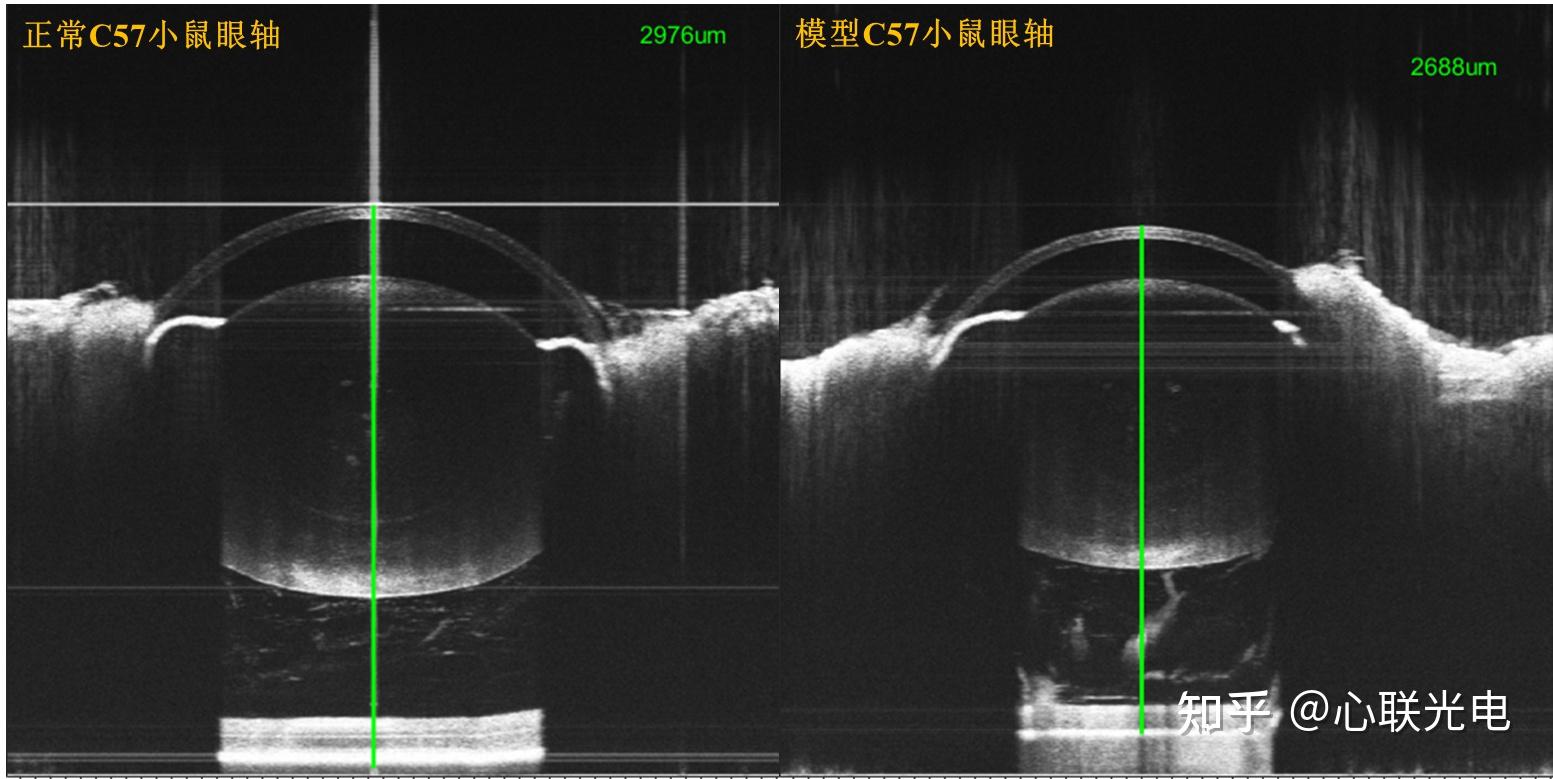 小动物眼轴及前节oct一体化成像系统 - 知乎