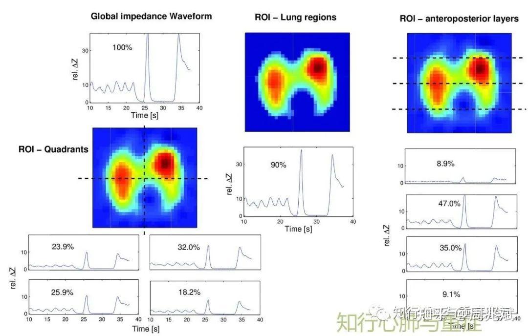 第139期胸部电阻抗断层成像（EIT）的原理、图像分析及临床应用 - 知乎