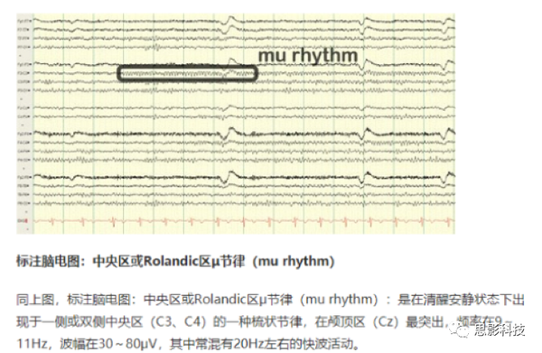 皮质运动兴奋性不受中央区mu节律相位的调节 - 知乎