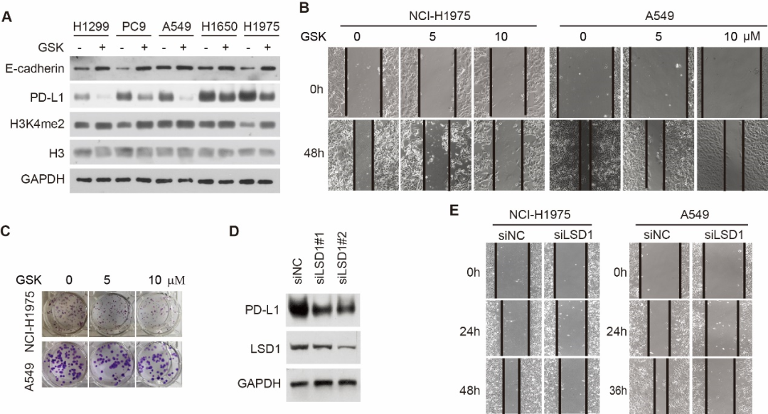 Genes Dis︱刘宏民/何鹏兴/徐义超团队发现阻断LSD1抑制肺腺癌增殖转移的新机制 - 知乎