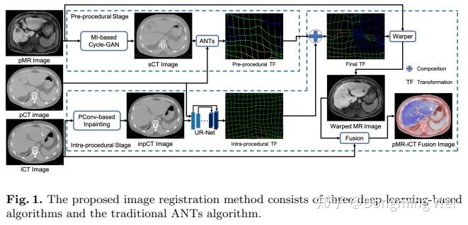 基于深度学习和图像引导的医学图像配准 - 知乎