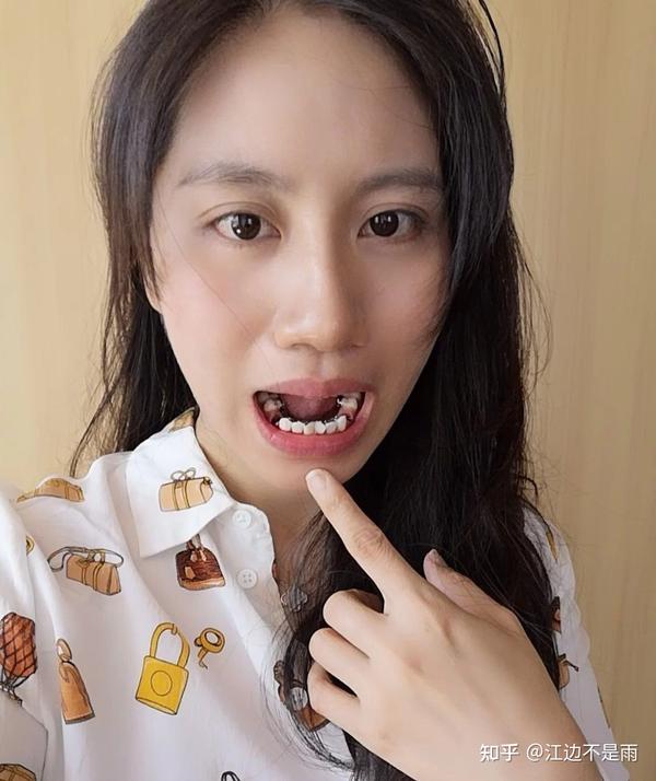 口臭怎么治,看看我的亲身经历! 知乎