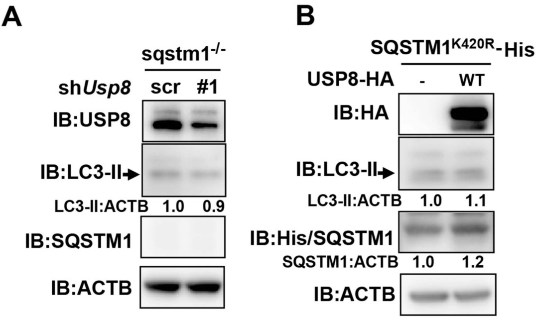 泛素特异性蛋白酶USP8直接对SQSTM1/p62进行去泛素化，以抑制其自噬活性 - 知乎