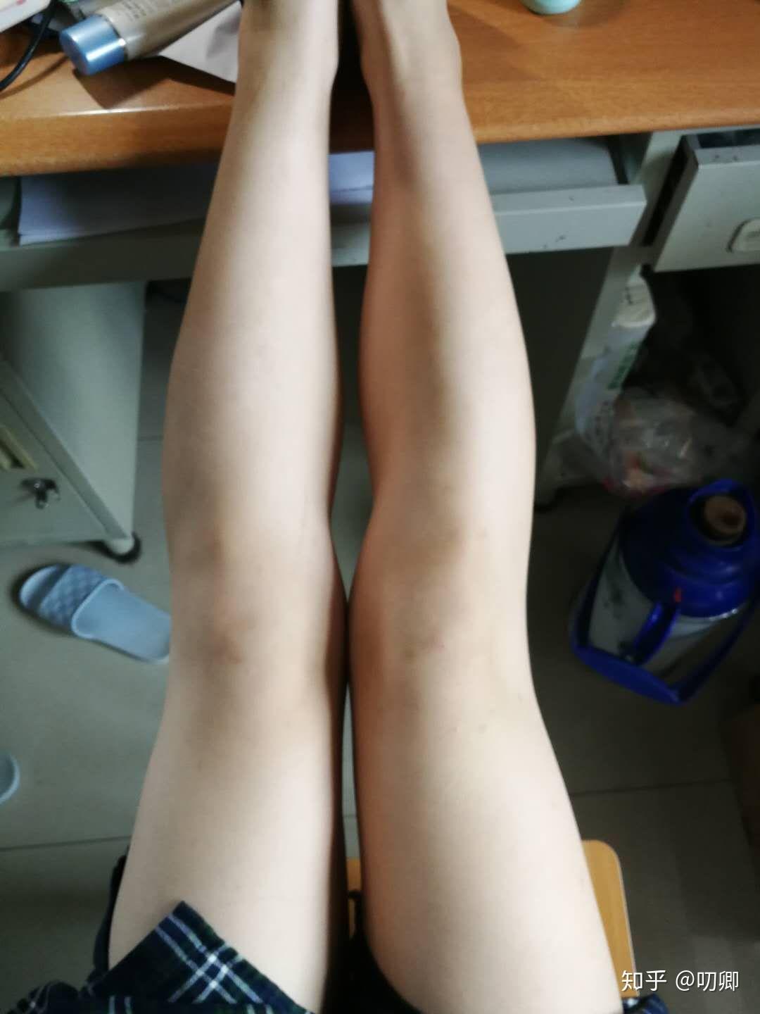 市面上的瘦腿霜有用吗? 知乎