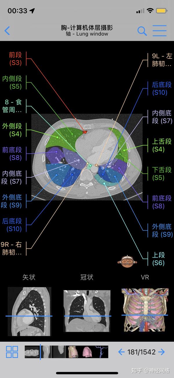 e-anatomy 超实用的临床断层解剖工具 - 知乎