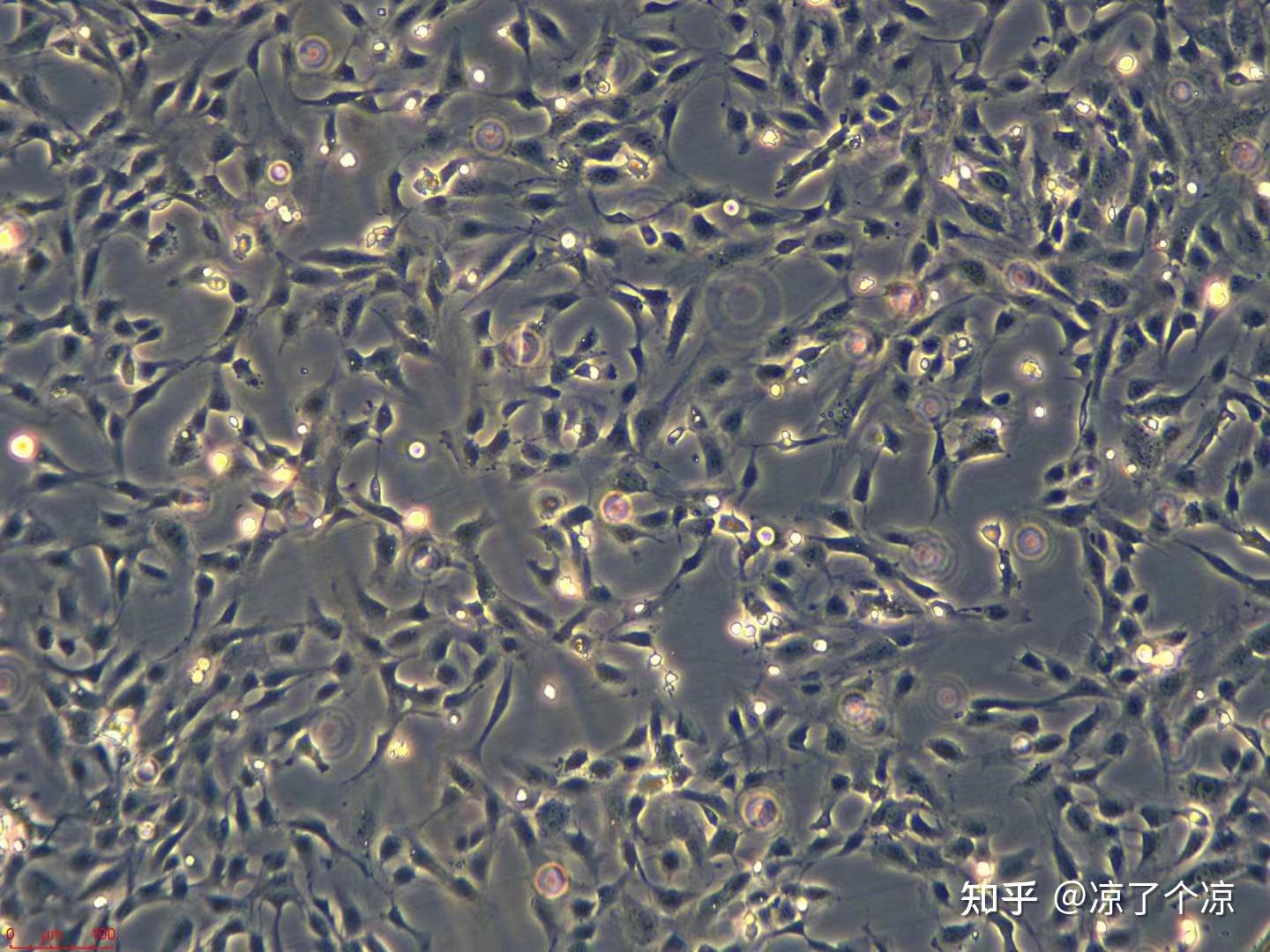 HMEC-1 MEISEN现货 引种自ATCC权威细胞库 - 知乎