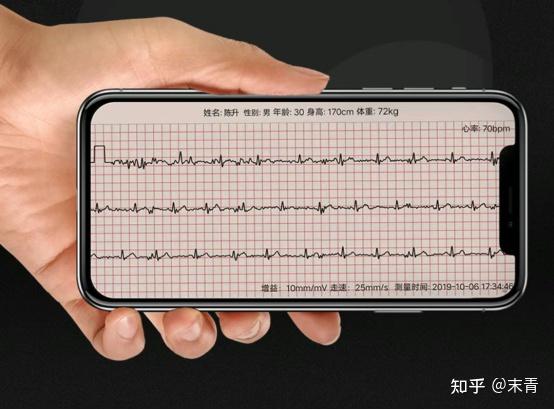 2022值得推荐的健康智能穿戴,dido E10智能手表——你的心脏健康管家 - 知乎