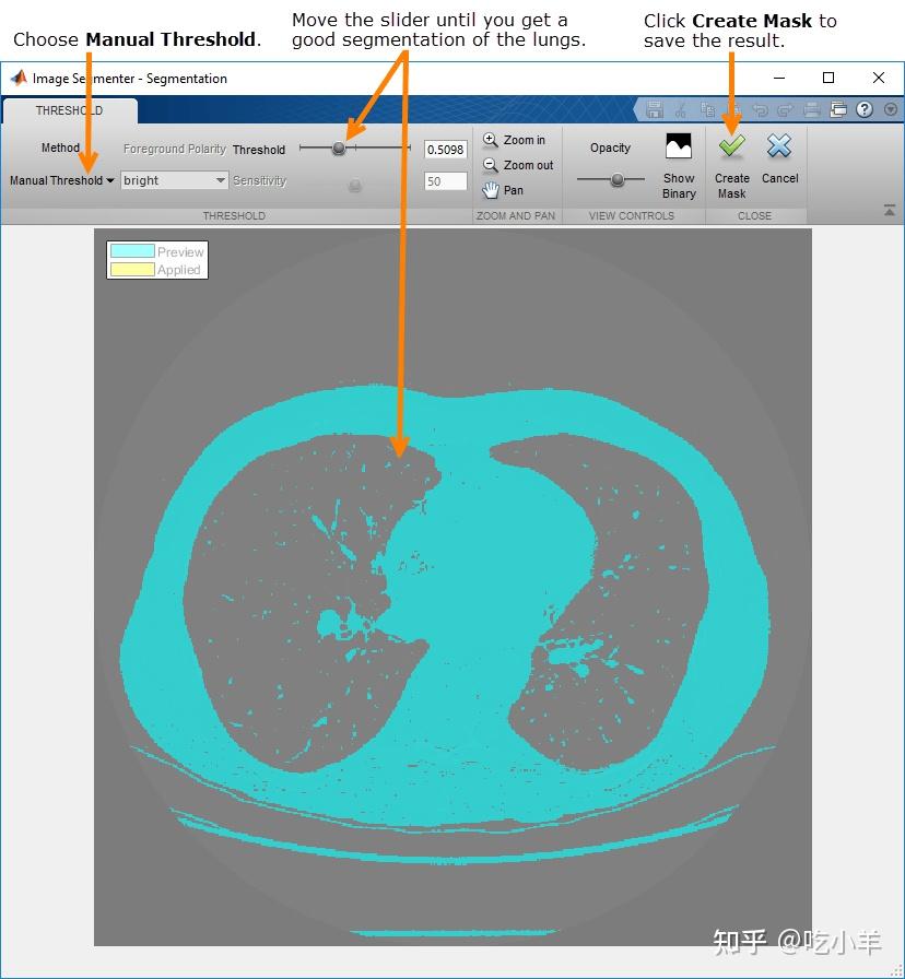 MATLAB图像处理：89：从 3-D 胸部扫描中分割肺 - 知乎