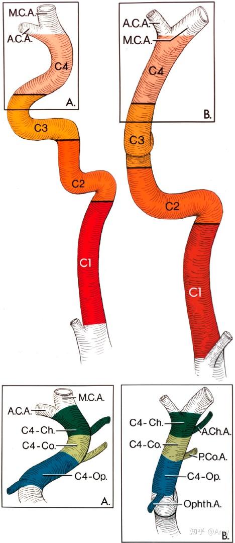 颈内动脉的8种分段系统 - 知乎